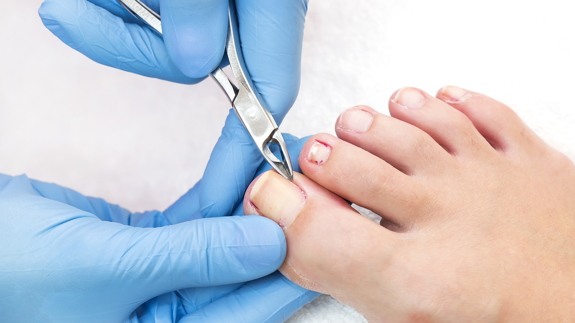 What is a podiatrist? - Morecroft's Podiatry Services, Lilydale